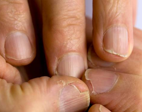 How to Repair Chipped and Cracked Nails - Tuesday in Love
